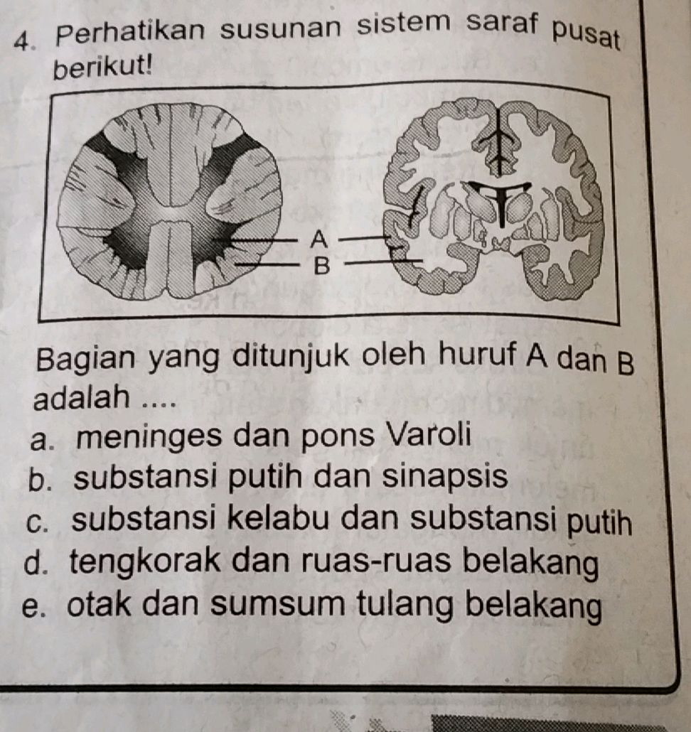Perhatikan susunan sistem saraf pusat | StudyX