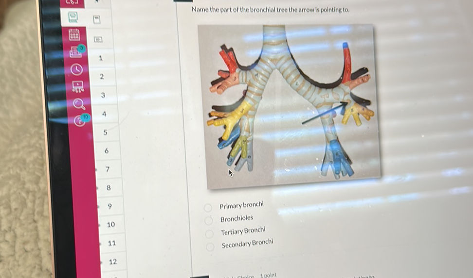 Name the part of the bronchial tree the | StudyX