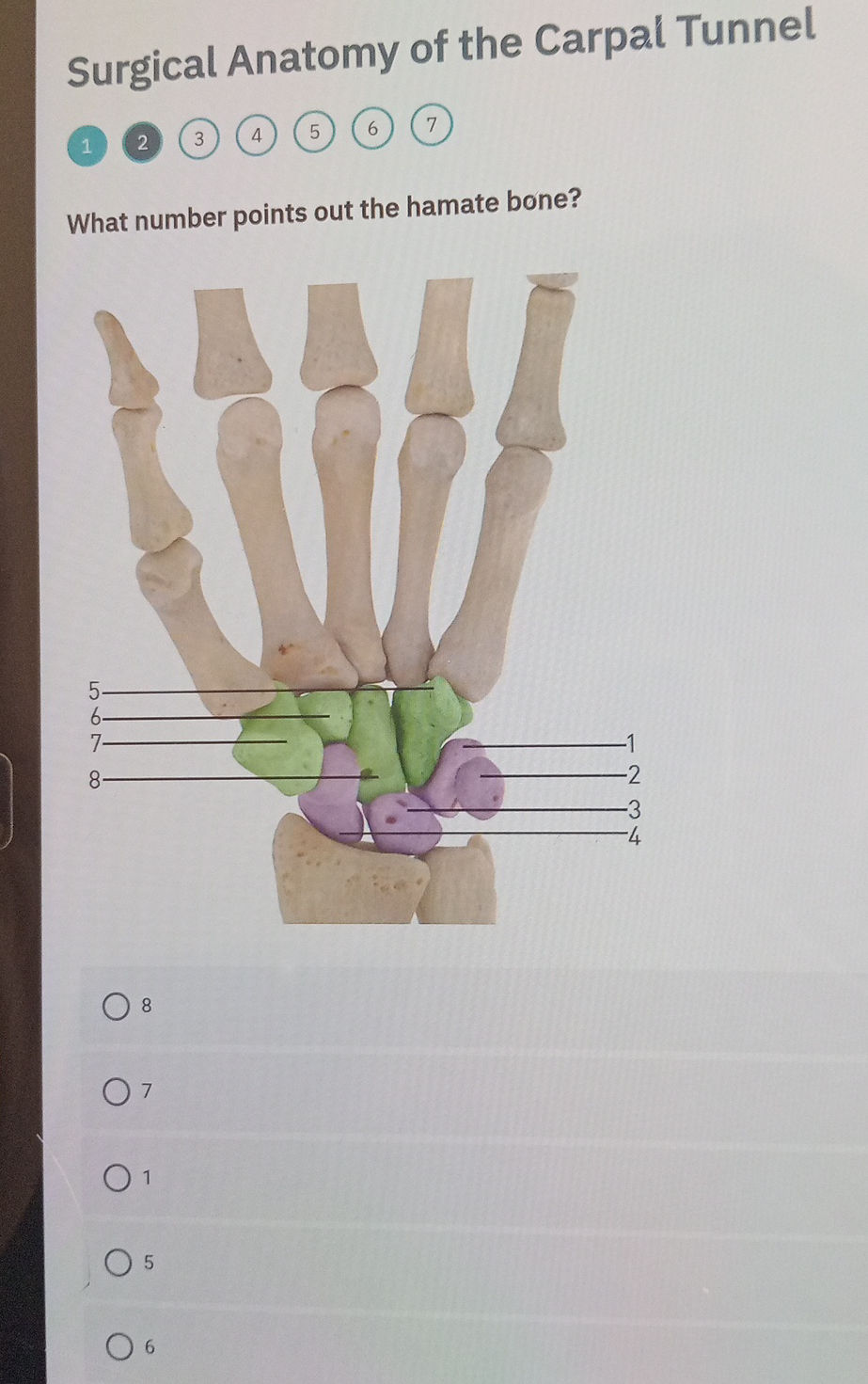 What number points out the hamate bone? 8 | StudyX
