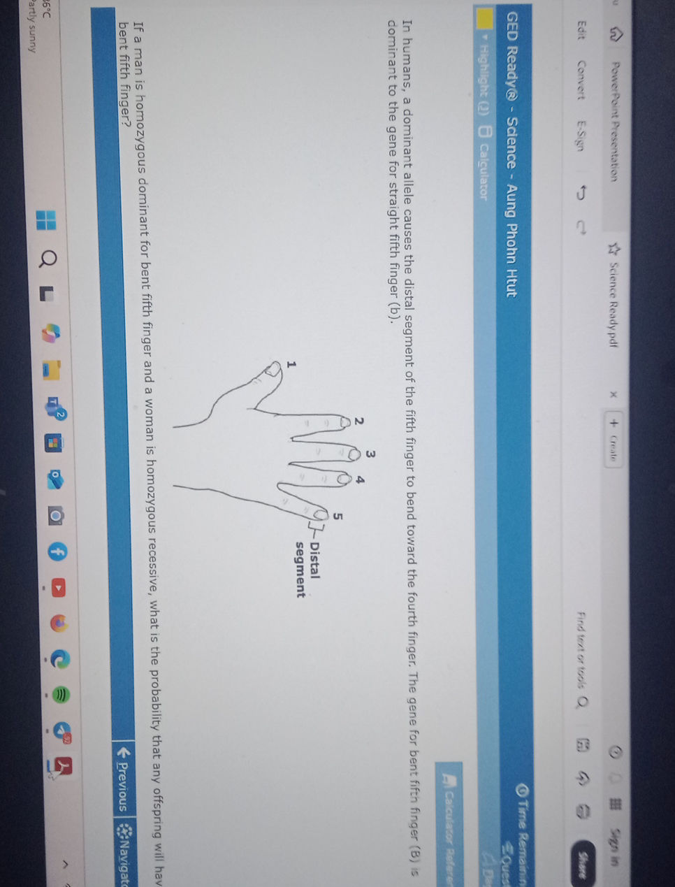 In humans, a dominant allele causes the | StudyX