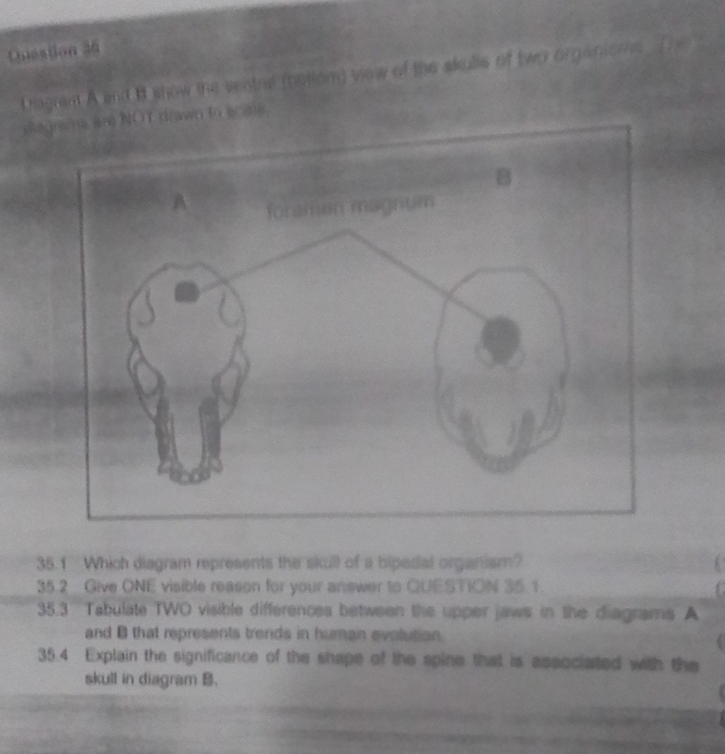 35.1 Which diagram represents the skull of a | StudyX