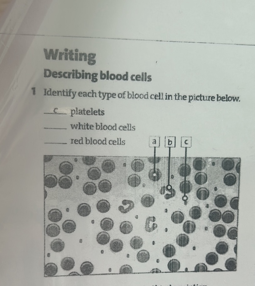 1 Identify each type of blood cell in the | StudyX