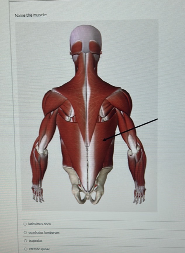Name the muscle: ![muscle diagram](image of | StudyX