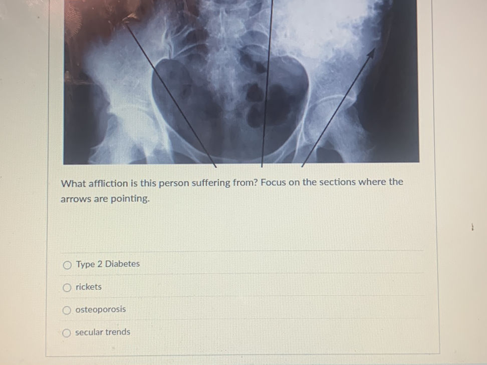 What affliction is this person suffering | StudyX
