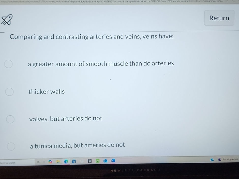 Comparing and contrasting arteries and | StudyX