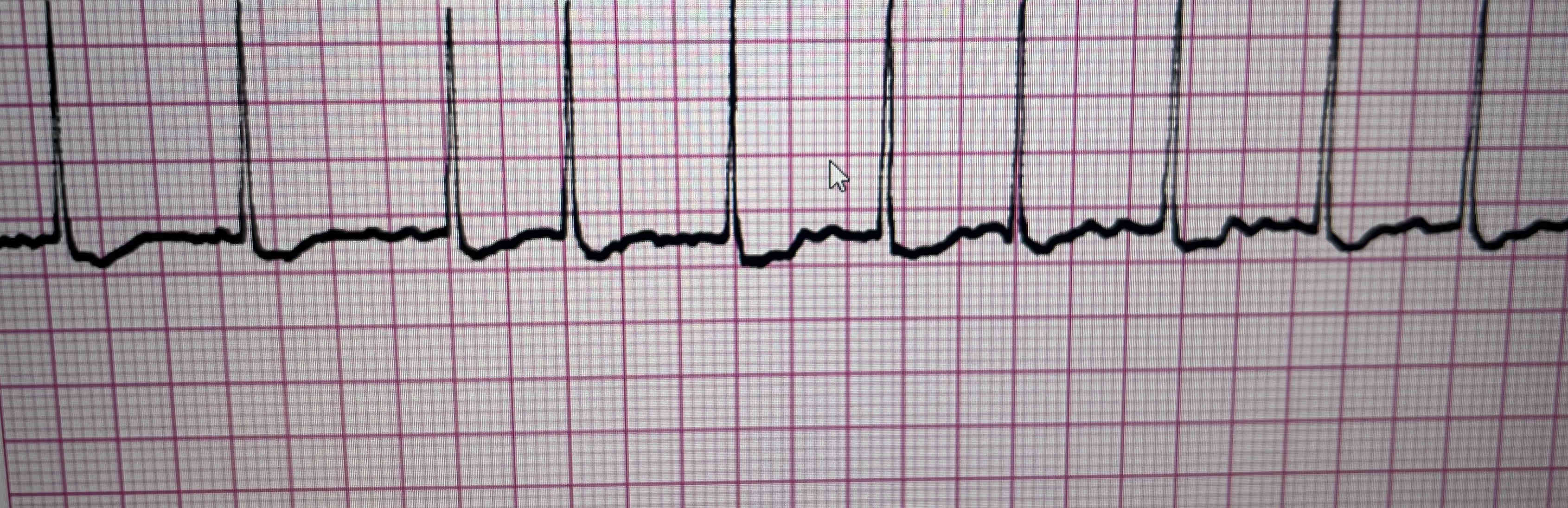 The image shows an ECG (electrocardiogram) | StudyX
