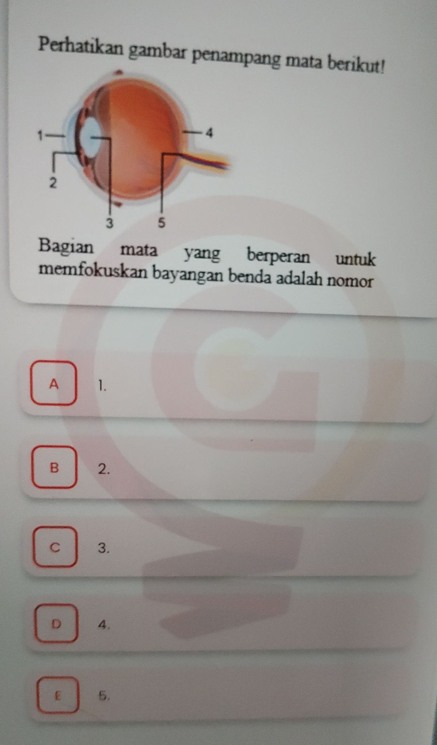 Perhatikan gambar penampang mata berikut! | StudyX