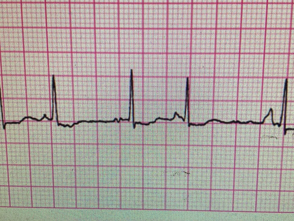 The image shows an ECG (electrocardiogram) | StudyX