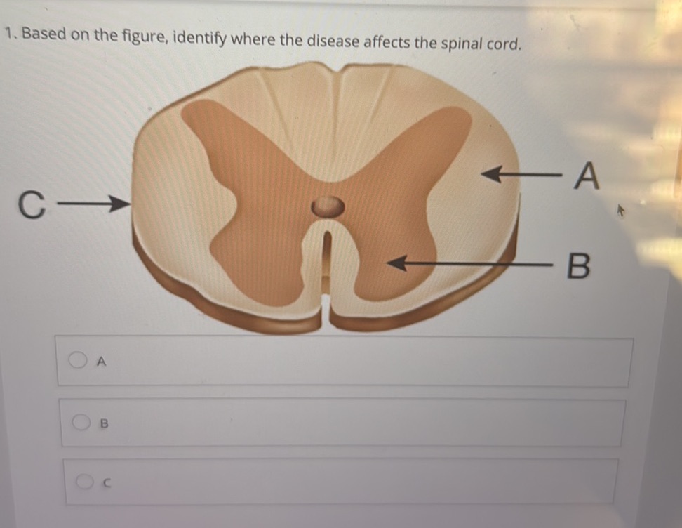 Based on the figure, identify where the