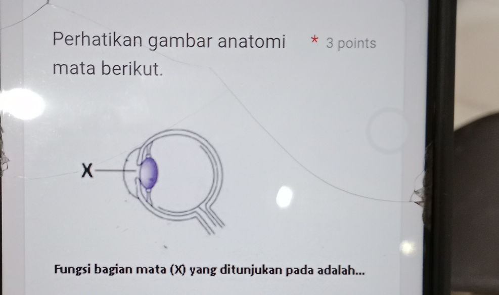 Perhatikan gambar anatomi mata berikut. | StudyX
