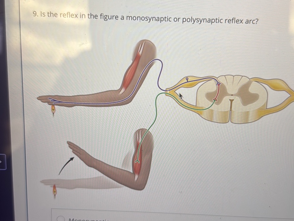 9. Is the reflex in the figure a | StudyX