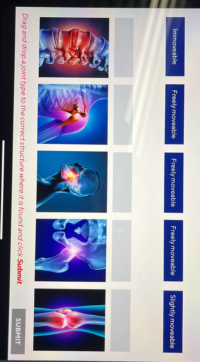 Drag and drop a joint type to the correct | StudyX