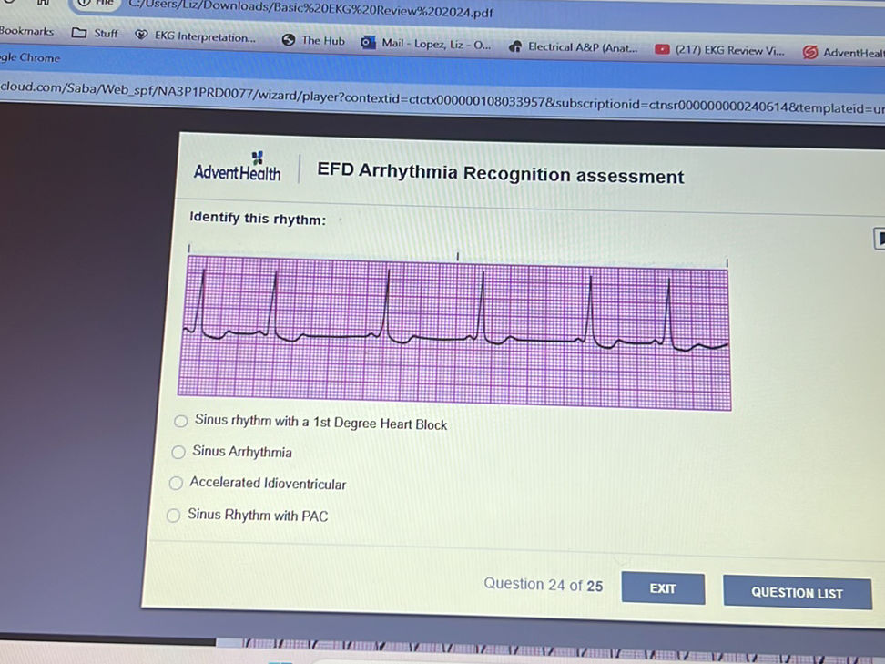Identify this rhythm: (Image of an EKG | StudyX