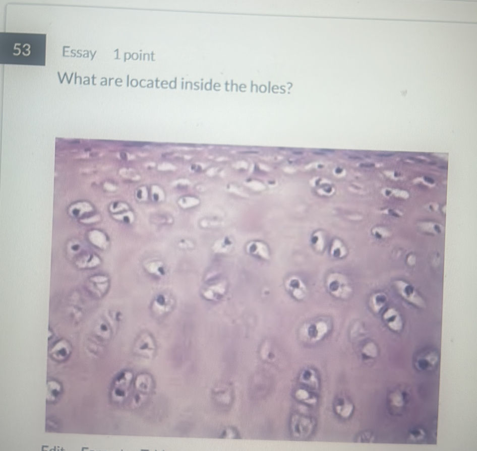 What are located inside the holes? | StudyX