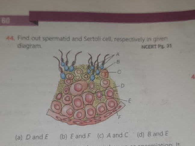 44. Find out spermatid and Sertoli cell, | StudyX