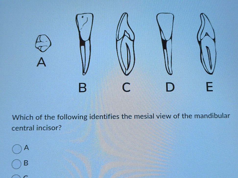 Which of the following identifies the mesial | StudyX