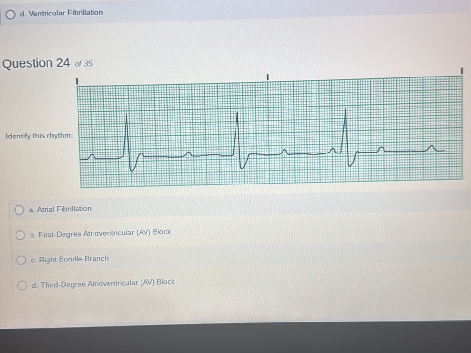 Identify this rhythm: a. Atrial | StudyX