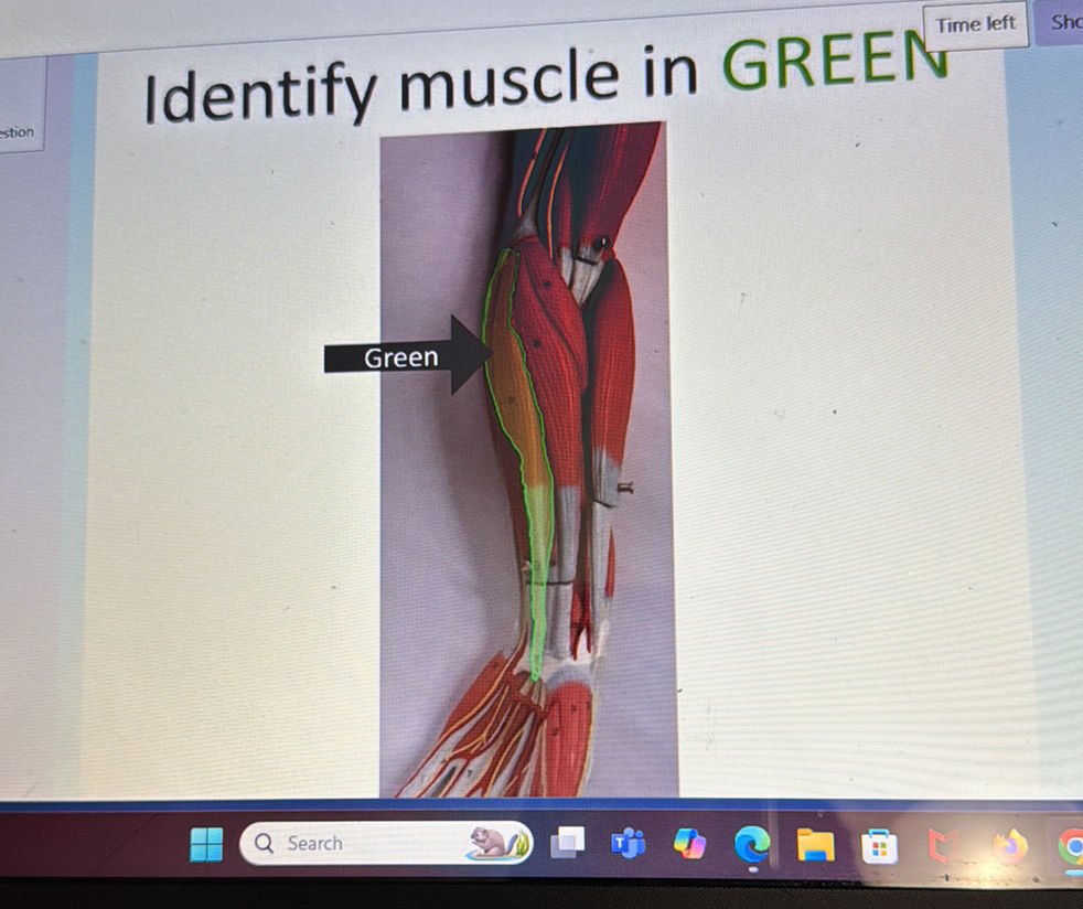 Identify muscle in green | StudyX