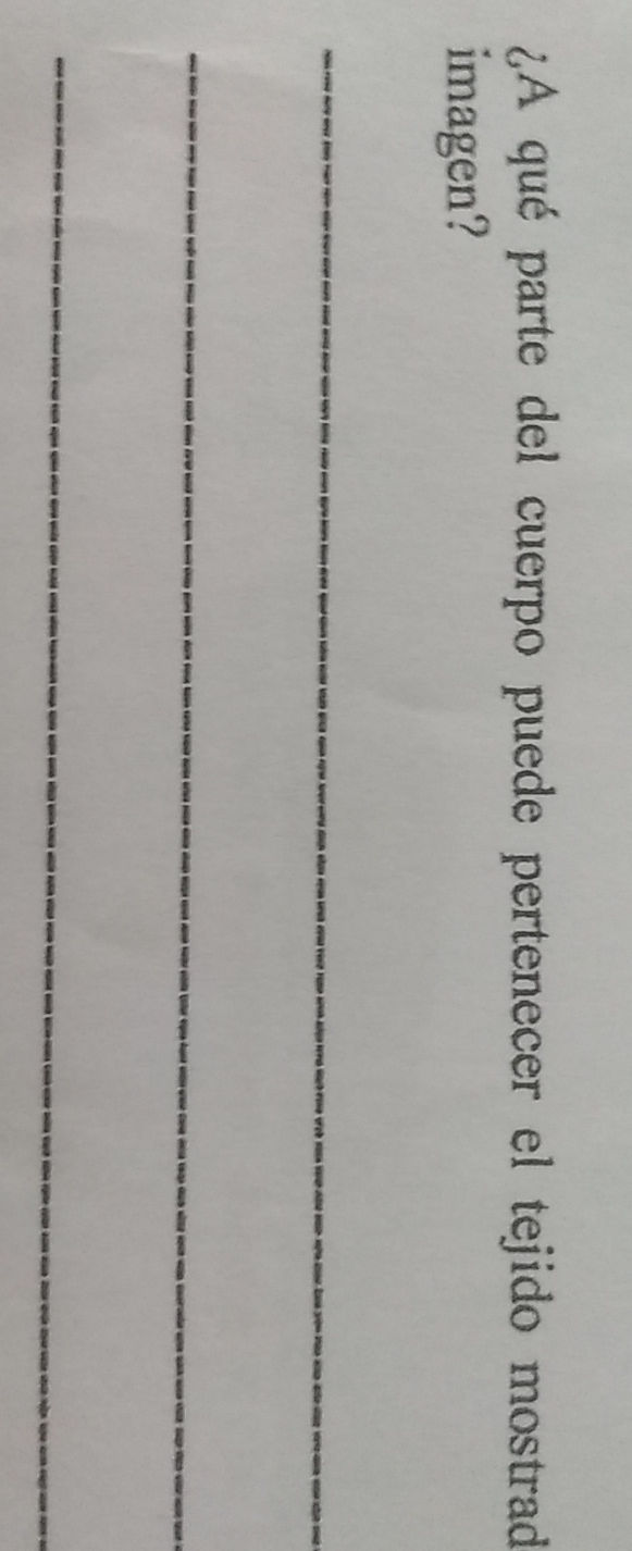 ¿A qué parte del cuerpo puede pertenecer el | StudyX