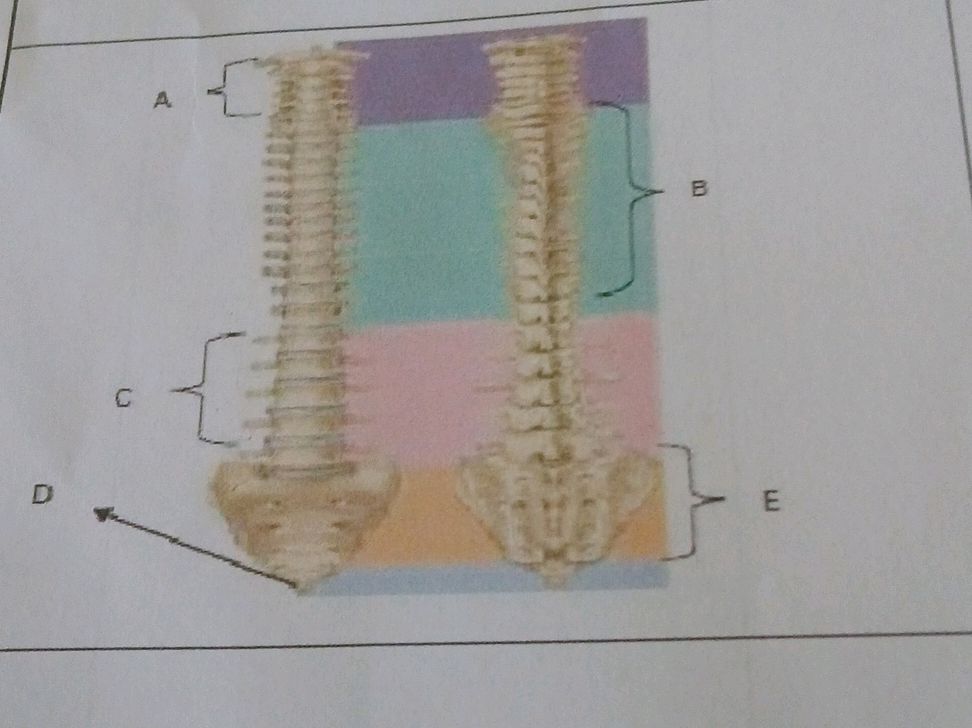 The image shows a diagram of the human spine | StudyX