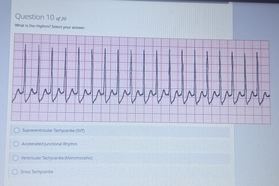 Question 10 of 20 What is the rhythm? | StudyX