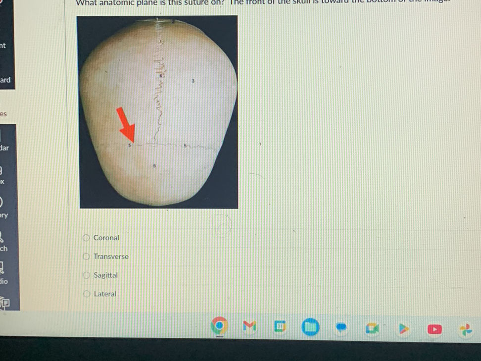 What anatomic plane is this suture on? | StudyX