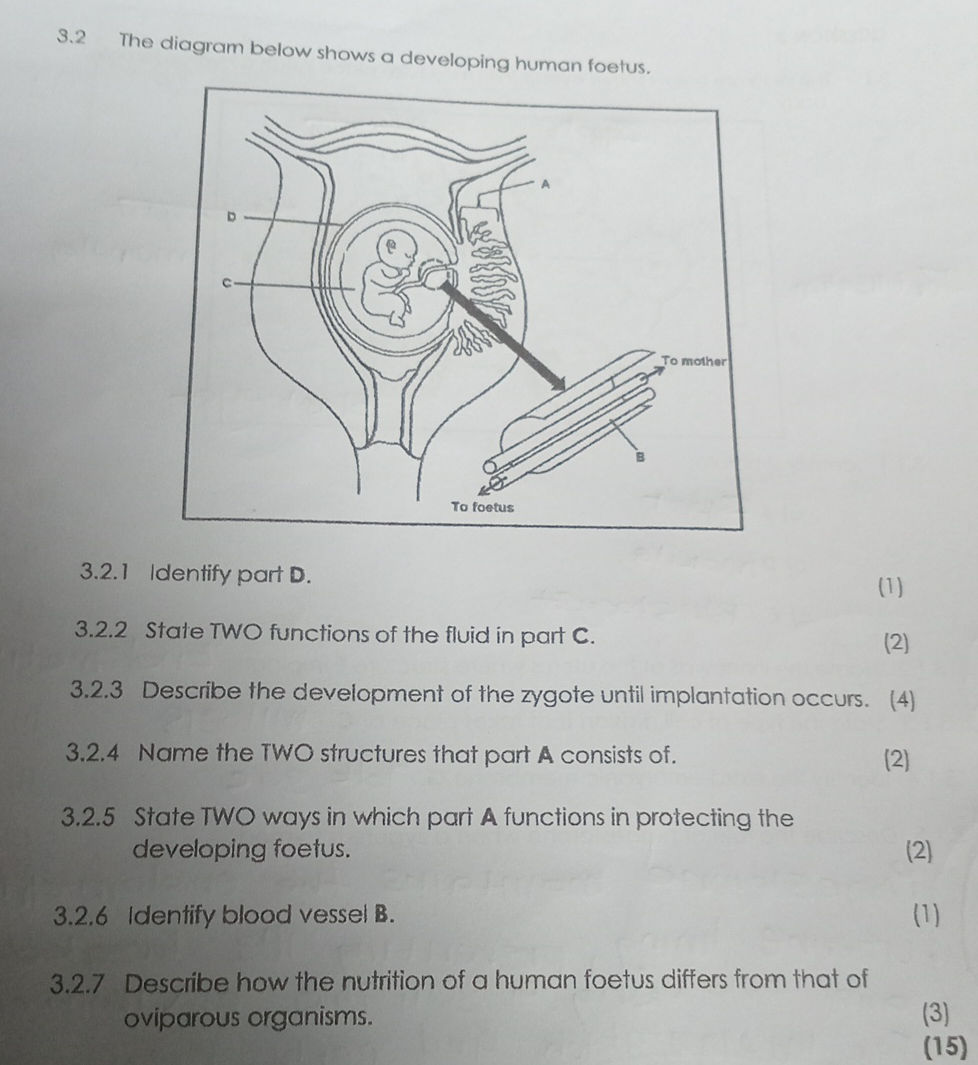 3.2 The diagram below shows a developing | StudyX