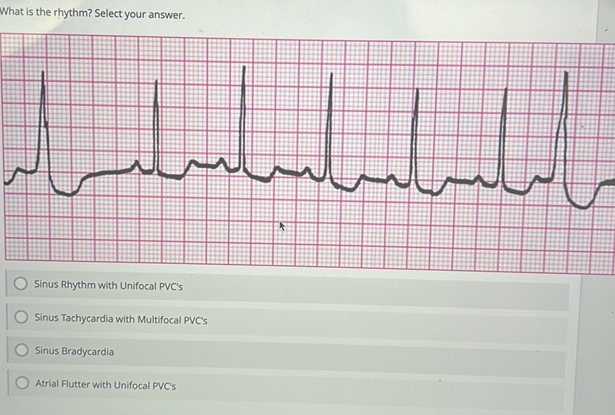 What is the rhythm? Select your answer. | StudyX