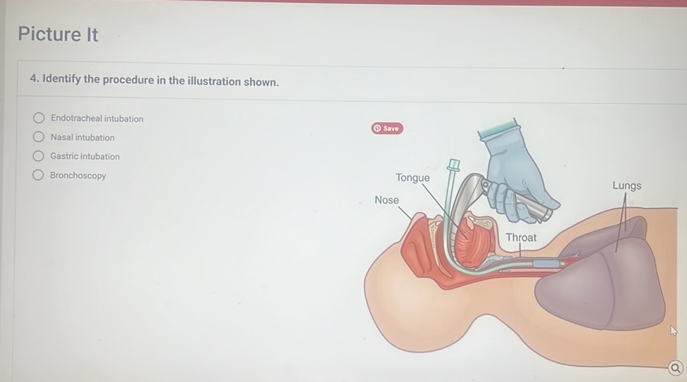 4. Identify the procedure in the | StudyX