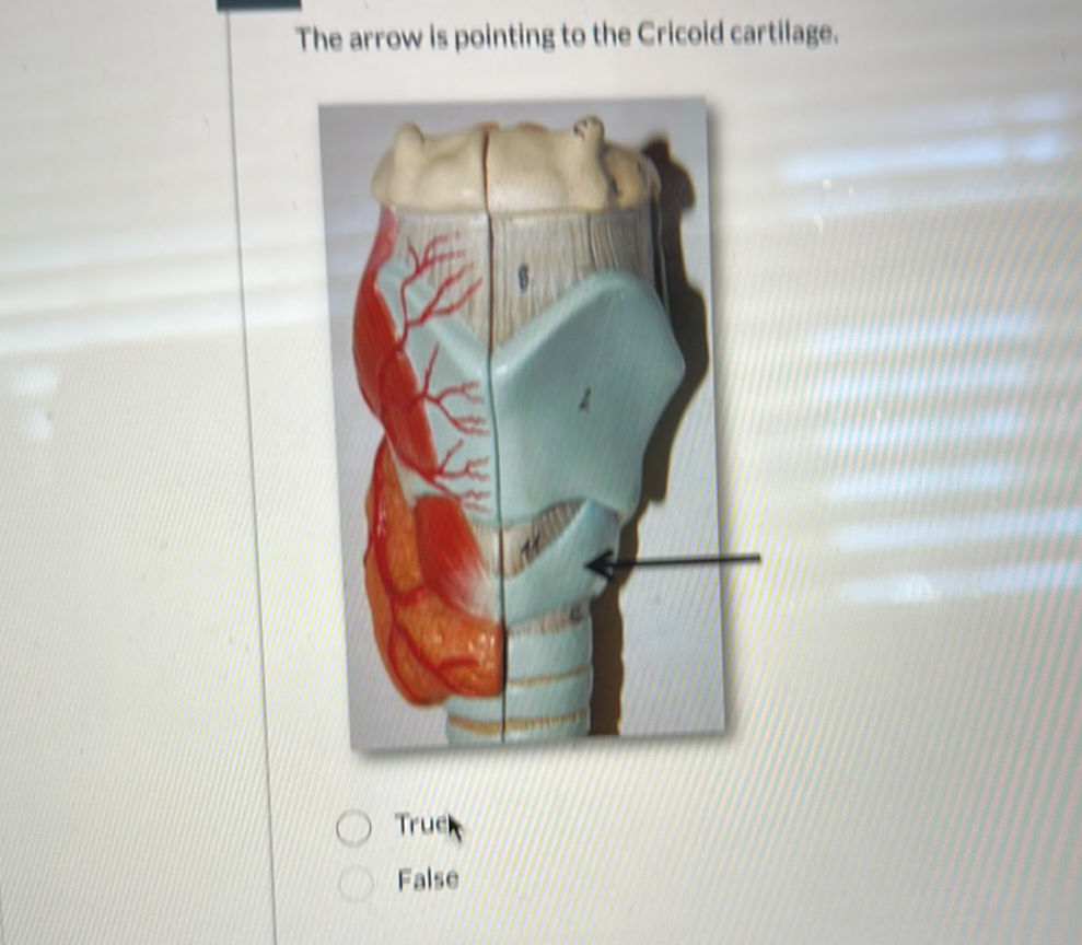 The arrow is pointing to the Cricoid | StudyX
