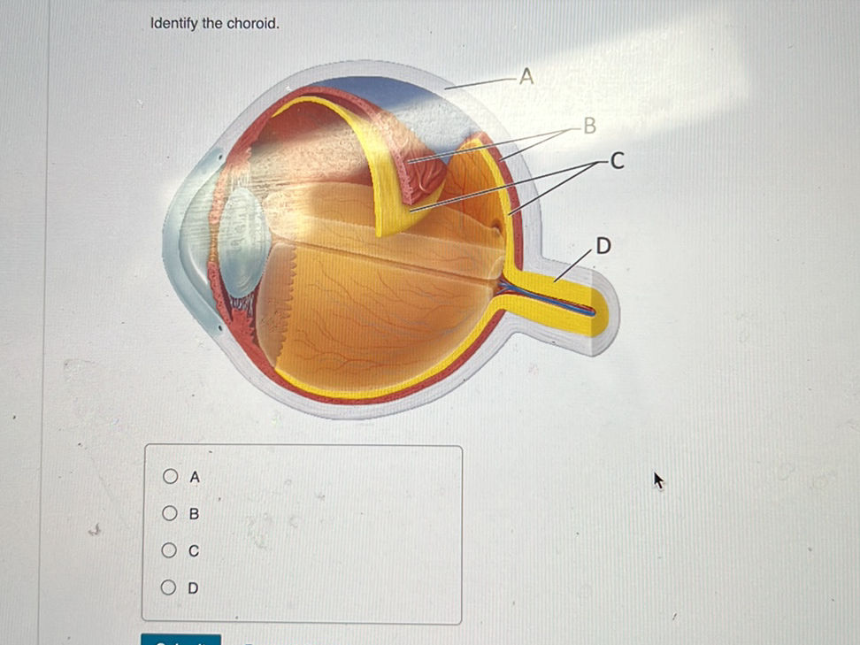 Identify the choroid in eye diagram | StudyX