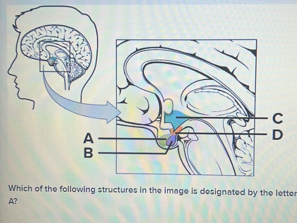 Which of the following structures in the | StudyX