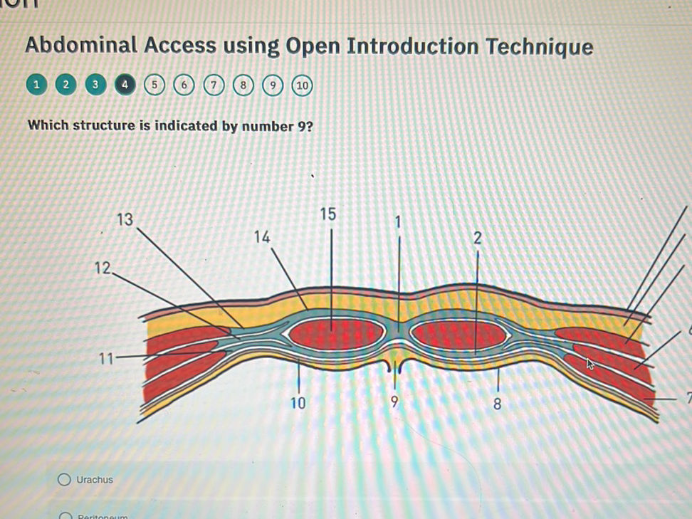 Which structure is indicated by number 9? * | StudyX