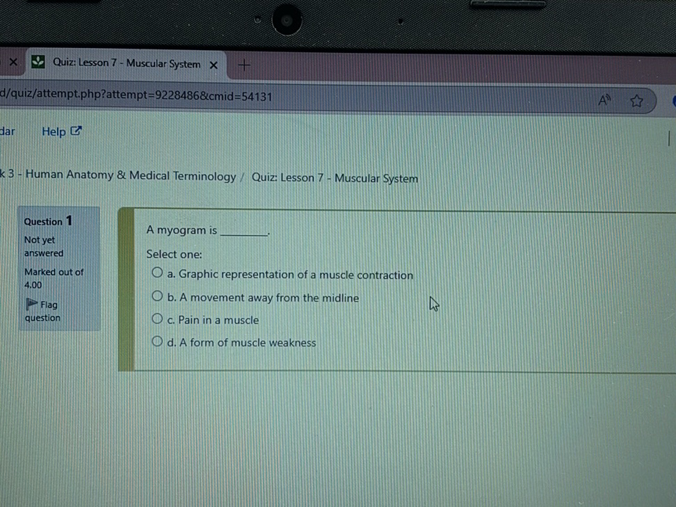 A myogram is _____ Select one: a. Graphic | StudyX