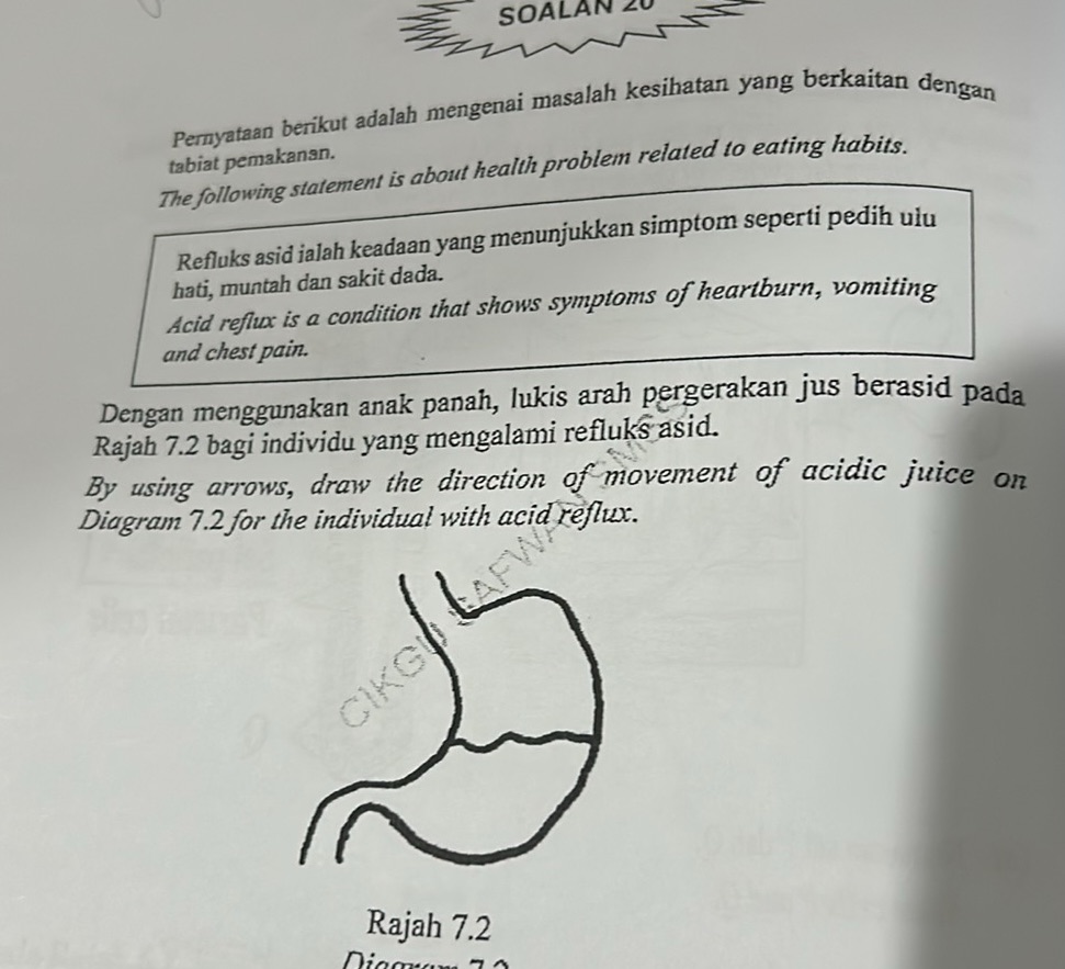 Refluks asid ialah keadaan yang menunjukkan | StudyX
