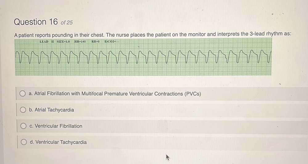 A patient reports pounding in their chest. | StudyX