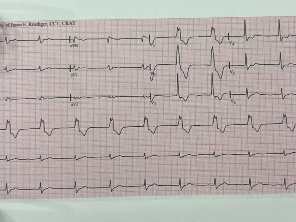 The image shows an ECG (electrocardiogram) | StudyX
