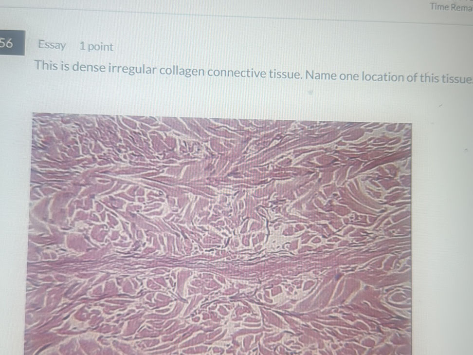 This is dense irregular collagen connective | StudyX