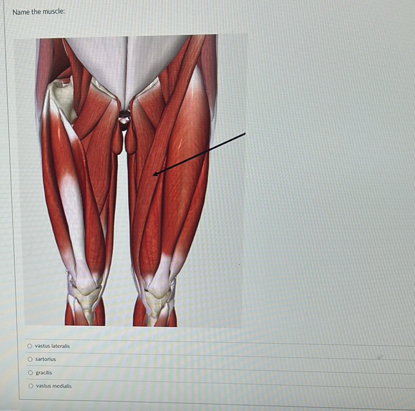 Name the muscle: * vastus lateralis * | StudyX