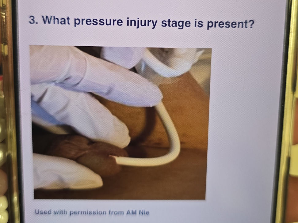 3. What pressure injury stage is present? | StudyX