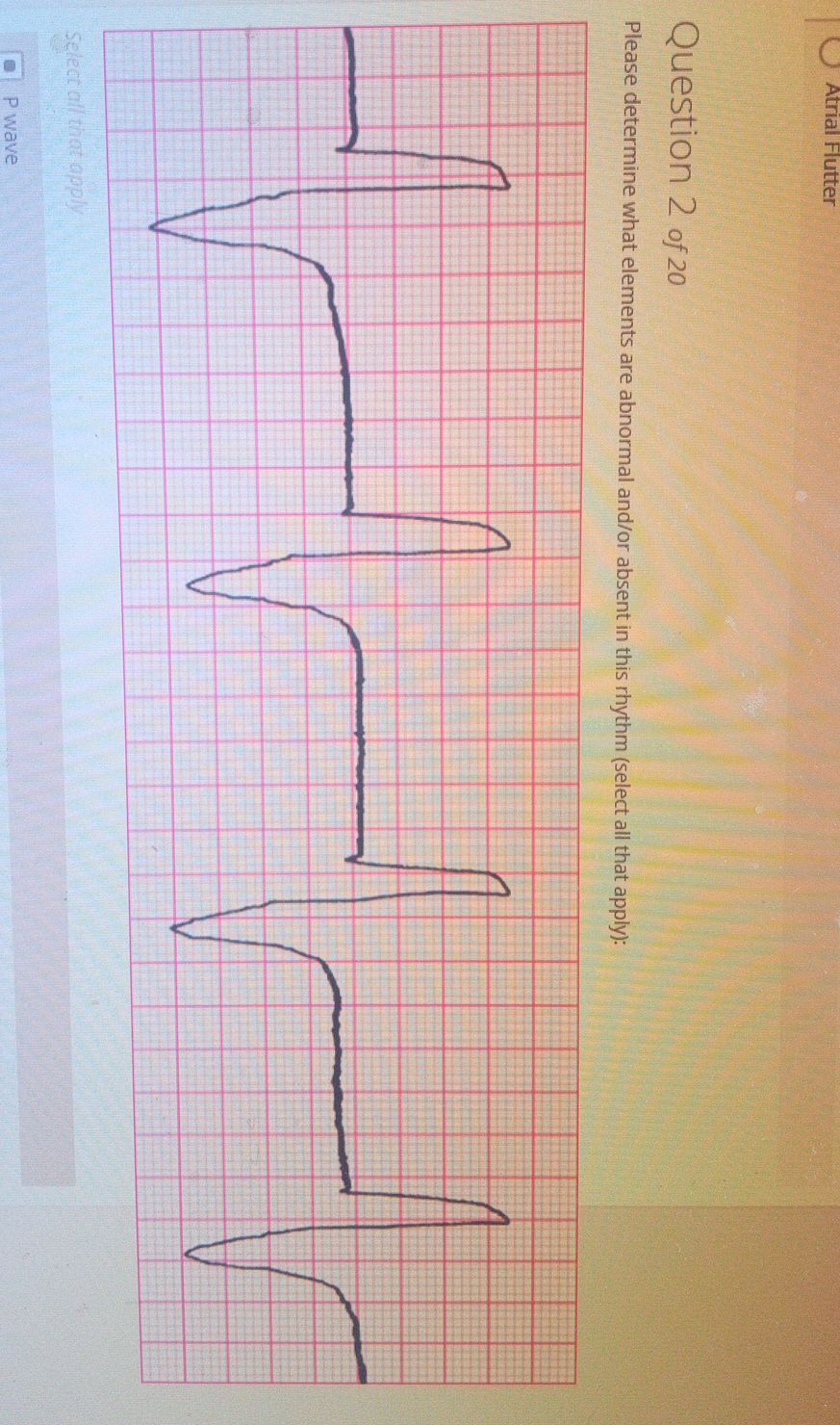 Question 2 of 20 Please determine what | StudyX