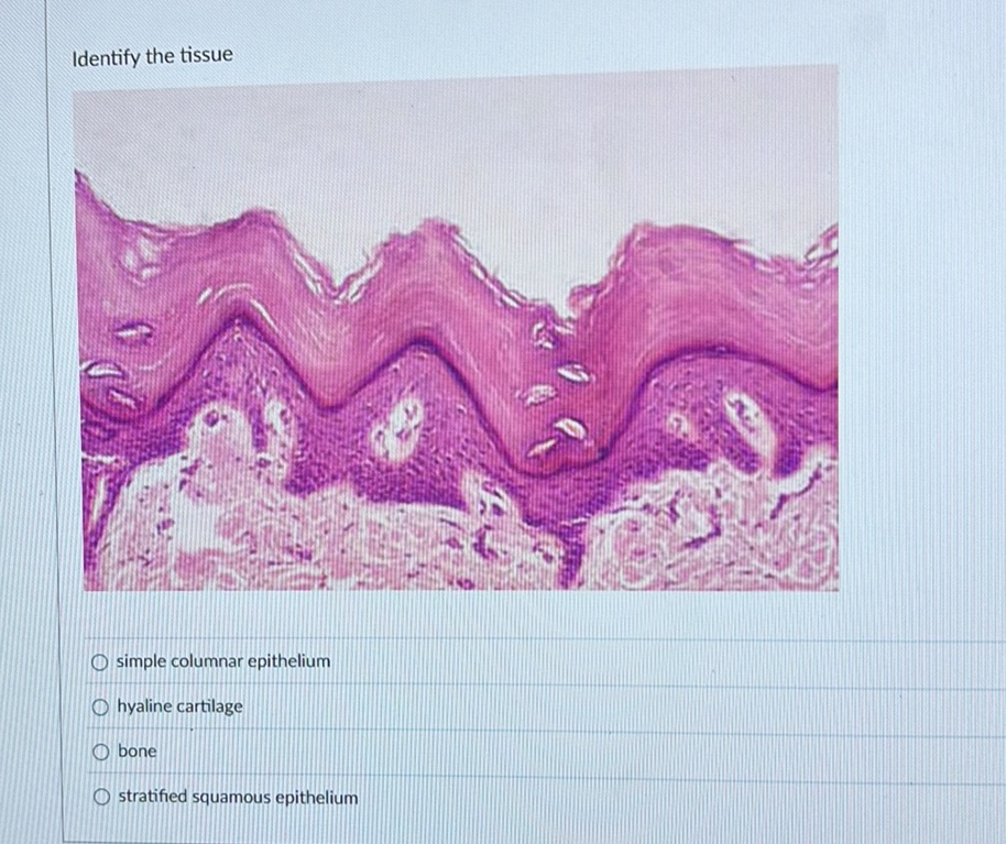 Identify the tissue * simple columnar | StudyX