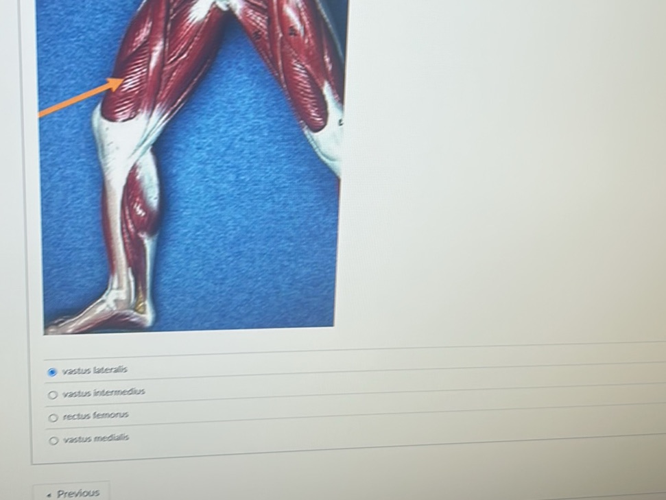 Which muscle is indicated by the arrow? | StudyX