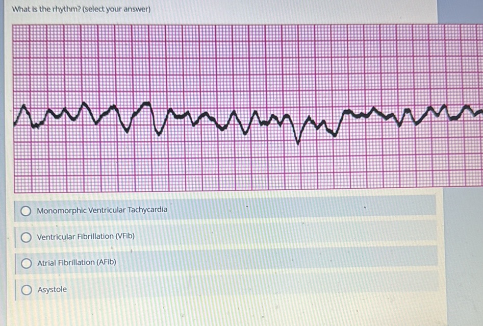 What is the rhythm? (select your answer) * | StudyX