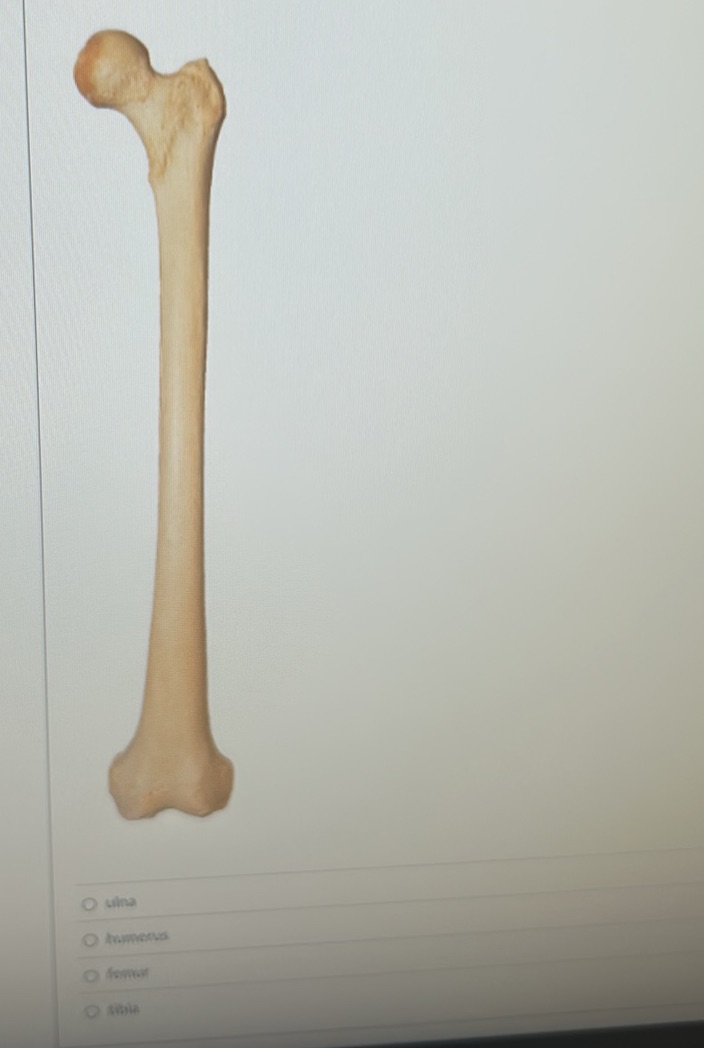 Which bone is shown in the image? * ulna | StudyX