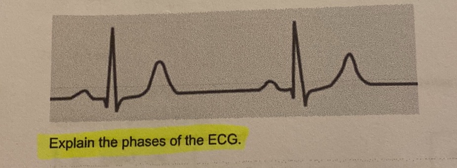ECG Phases Explained | StudyX