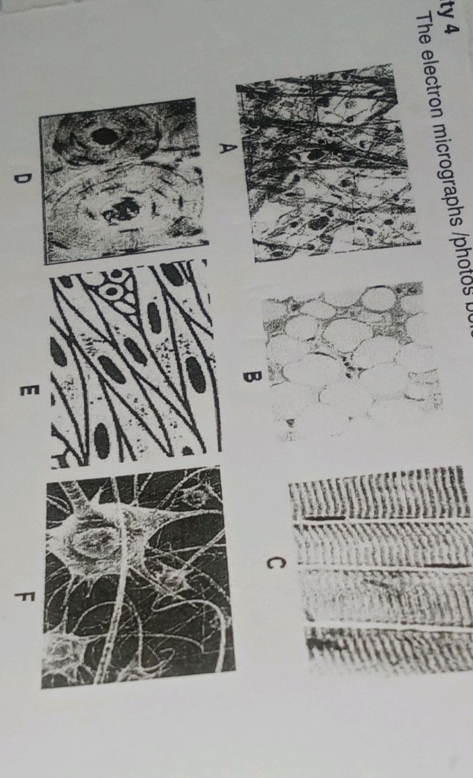 The electron micrographs / photos below: A | StudyX