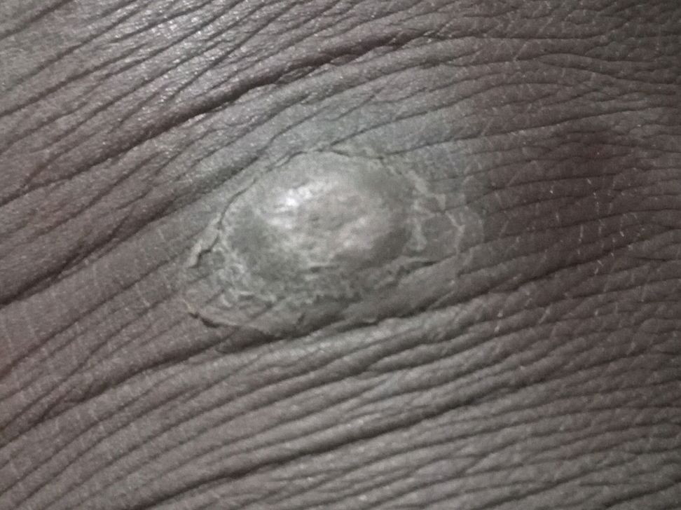 The image shows a skin lesion. Without | StudyX