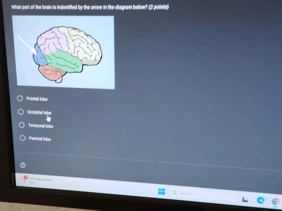 What part of the brain is indentified by the | StudyX