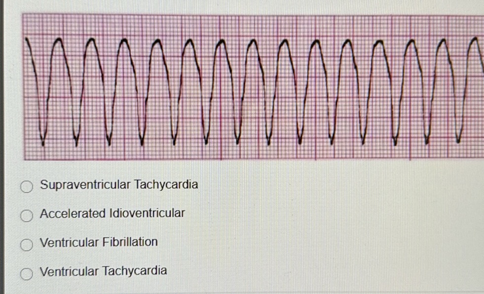 Which of the following is represented by the | StudyX